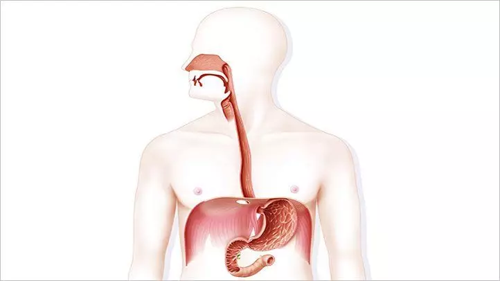 GERD اور Esophagitis: اسباب، علامات اور تشخیص