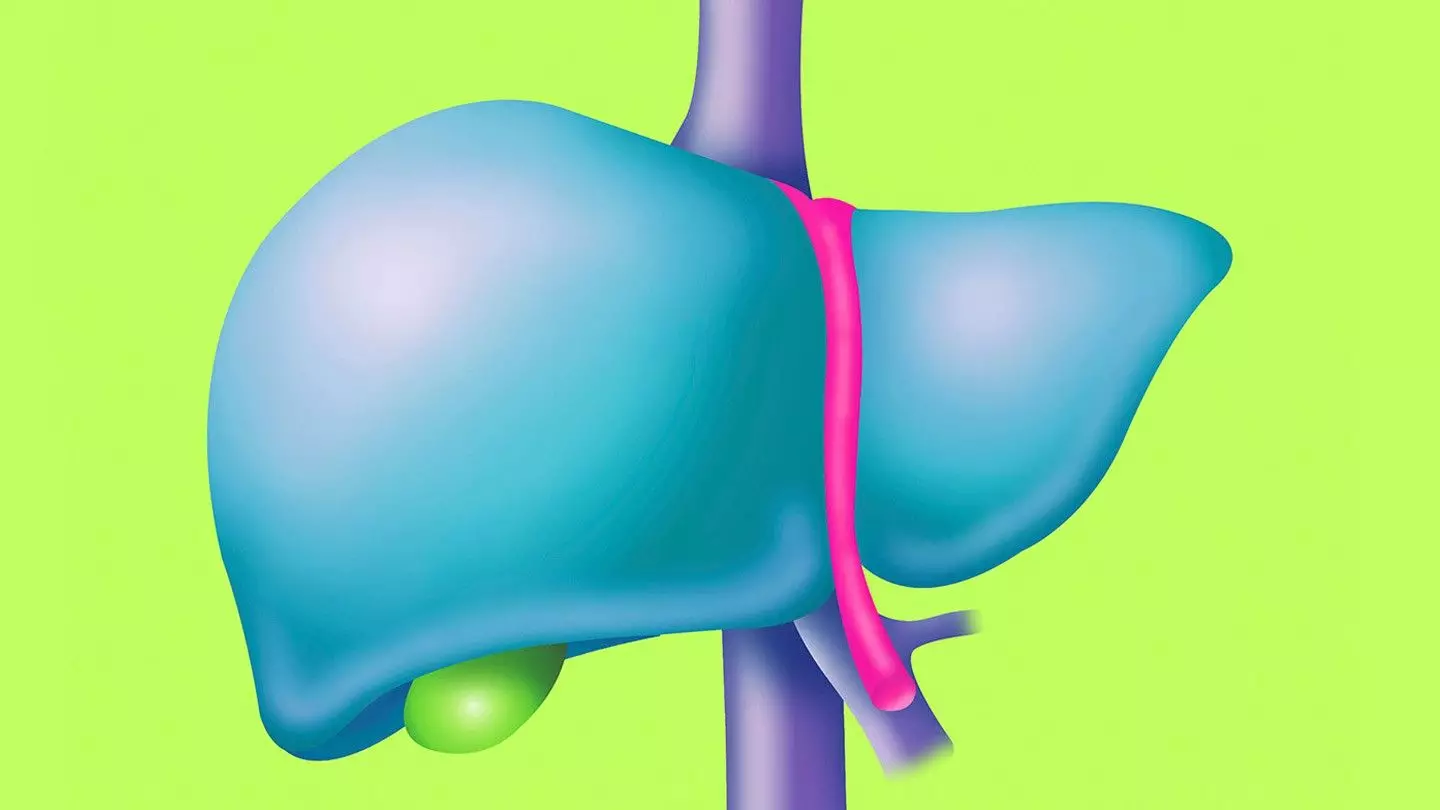 Jinsi Bile Acid Sequestrants Husaidia Kupunguza Cholesterol