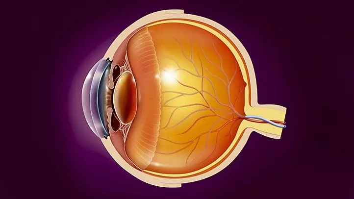 سڀ Optic Neuritis بابت