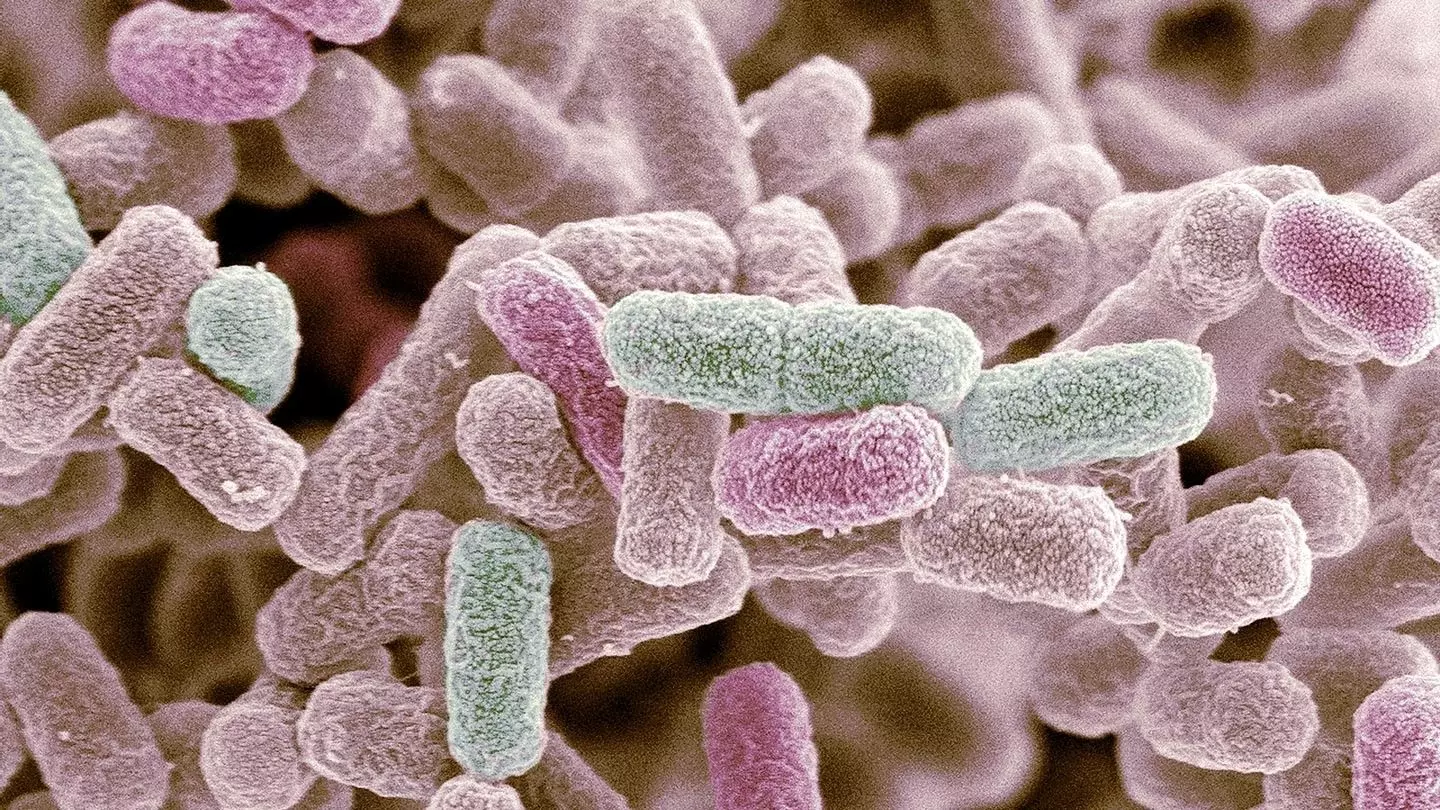 image microscopique d'e. coli