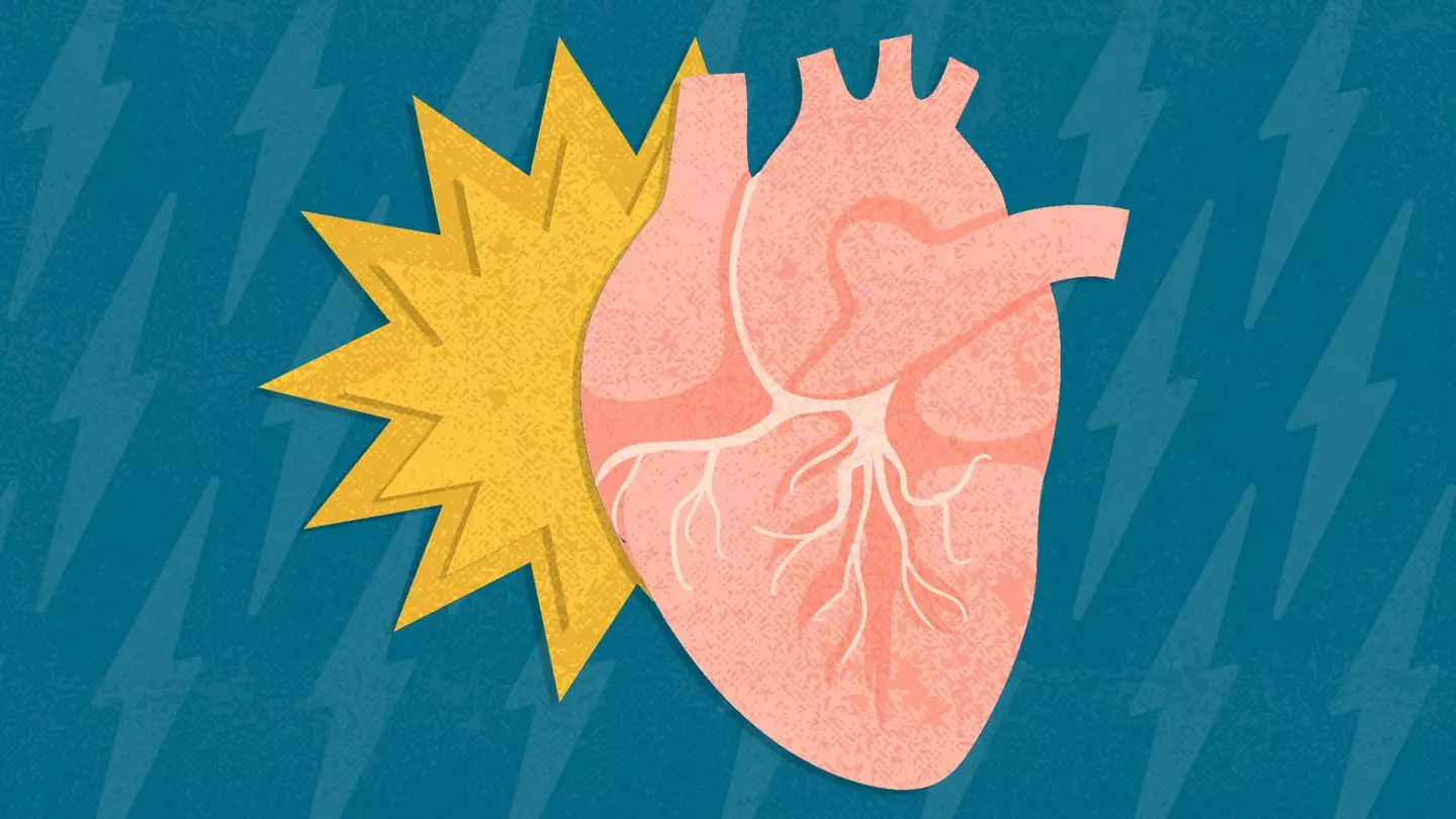 Altos níveis de estresse podem aumentar o risco de ataque cardíaco e derrame, mesmo com pressão arterial normal