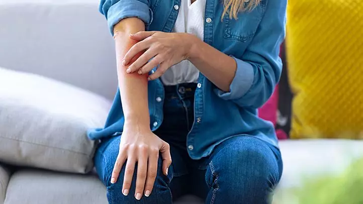 Bu səfeh sedefidir? Psoriasis Şəkilləri və daha çox