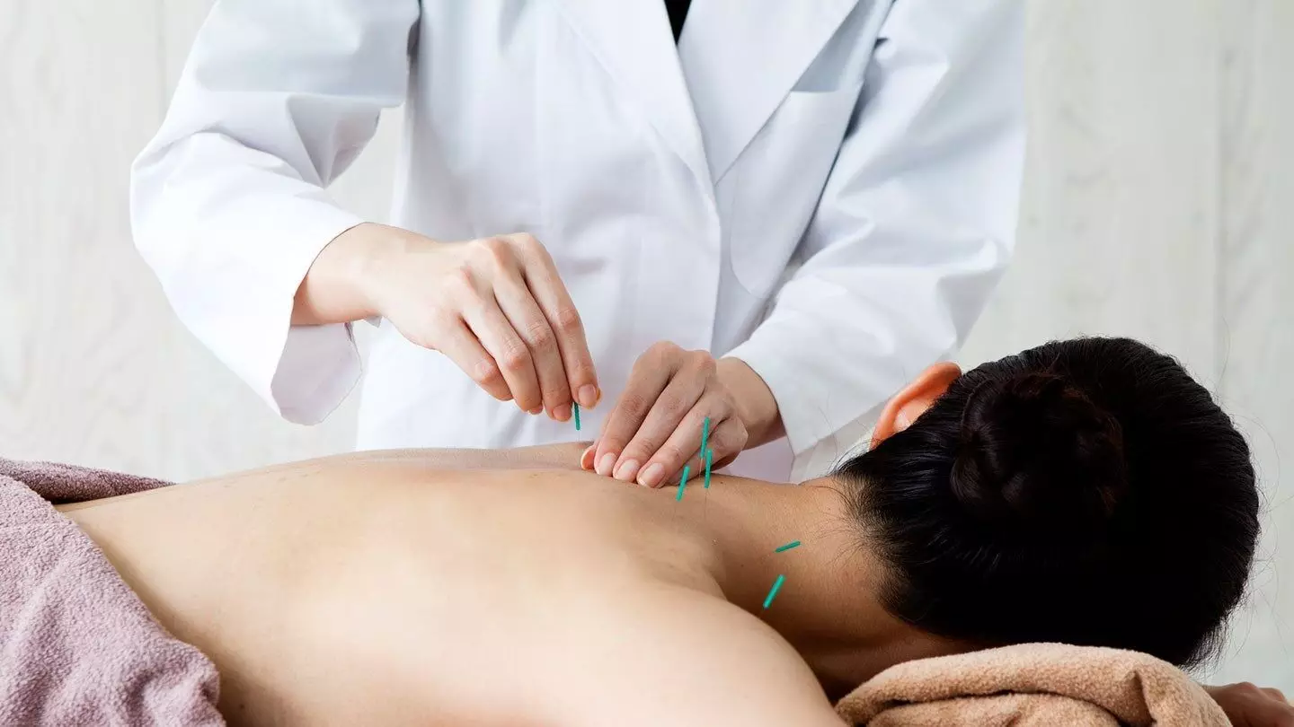 une personne faisant de l'acupuncture