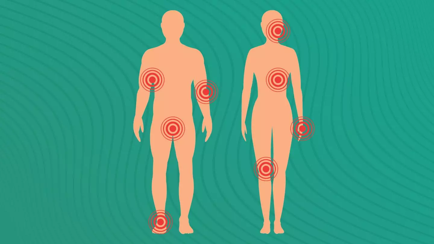 Poussées de psoriasis dans les zones sensibles