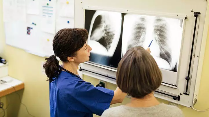 Când cancerul pulmonar non-microcelular se răspândește