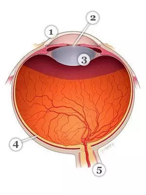 ಕಣ್ಣುಗಳು ಹೇಗೆ ಕೆಲಸ ಮಾಡುತ್ತವೆ