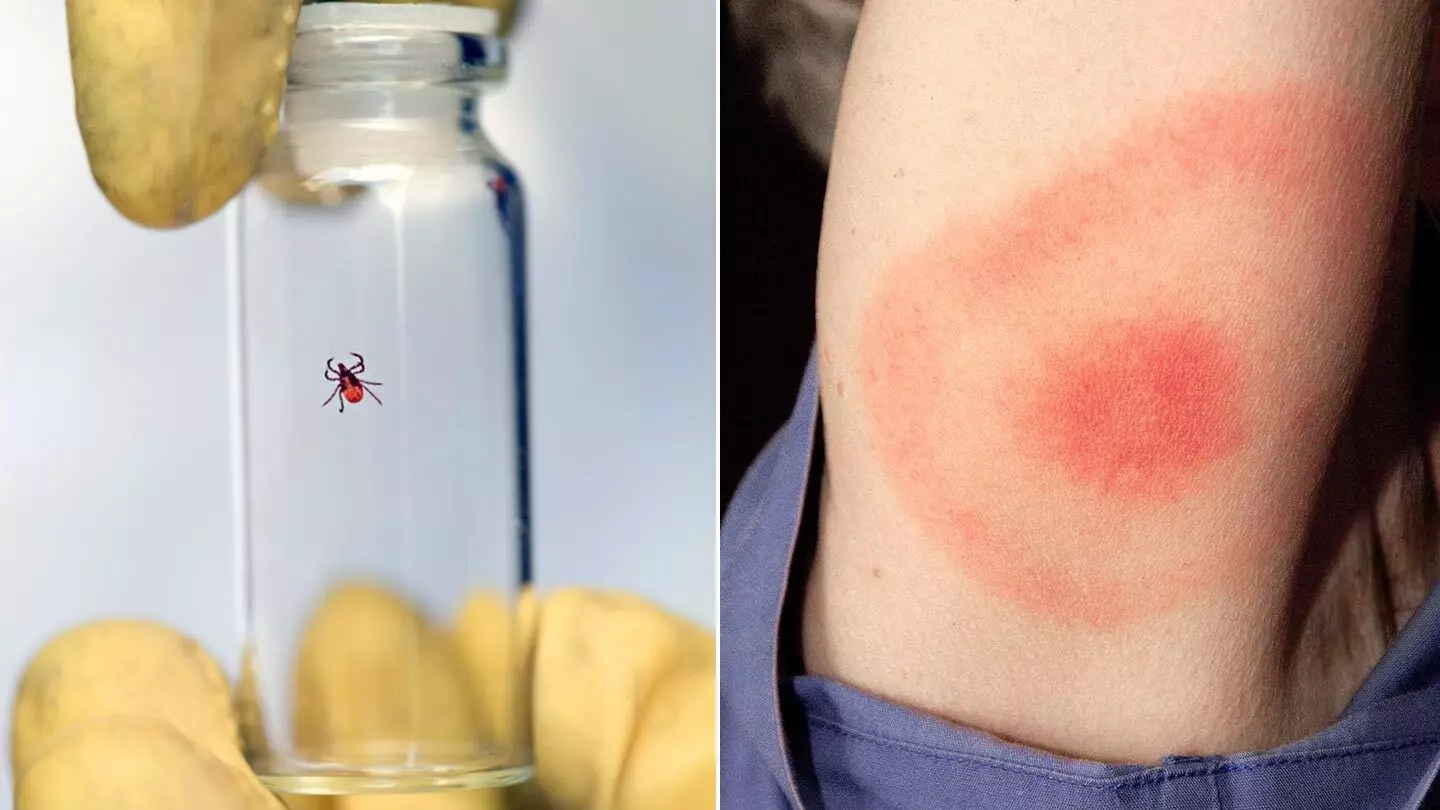 Ang pinaakan sa deer tick mahimong hinungdan sa usa ka seryoso nga impeksyon sama sa Lyme disease.