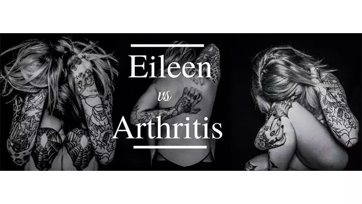 Eileen und Arthritis