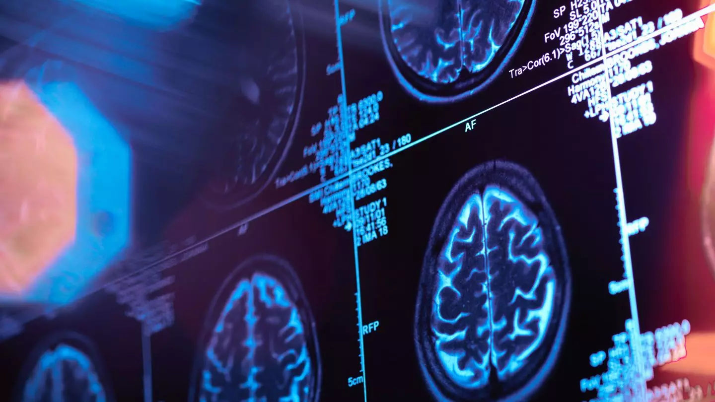 Skenování lidského mozku na neurologické klinice