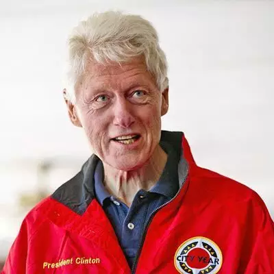 Bill Clinton rosacée