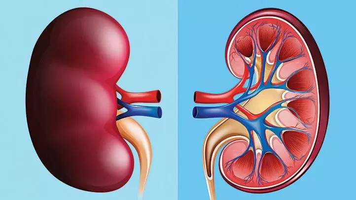 گردے کی ناکامی کی مثال